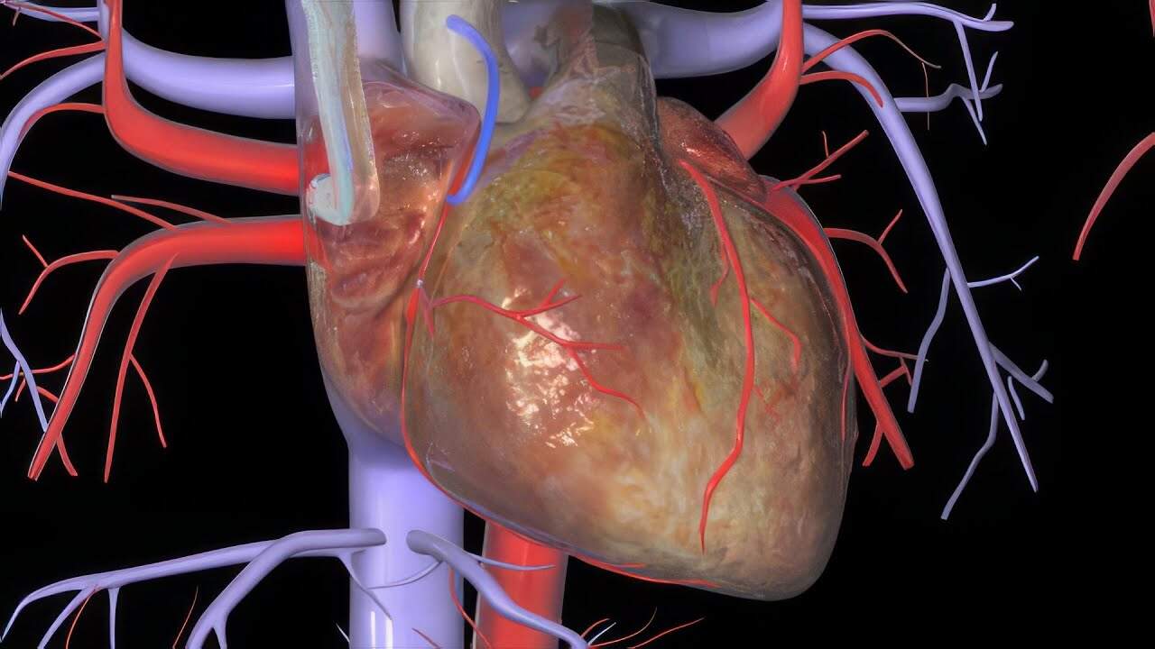RML Hospital Sets Global Milestone with Rare Heart Surgery on Woman ...